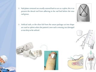 Finger tip injury | PPTX