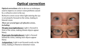 FINIAL. Eye as a camera system for human | PPTX
