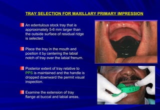 Finished complete denture impression presentation final modification | PPT
