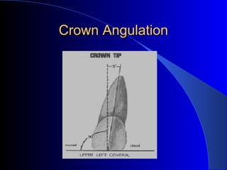 Finishing and detailing in straight wire technique / fixed orthodontics ...