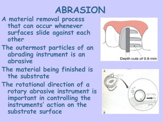 Finishing and polishing in dental materials.ppt