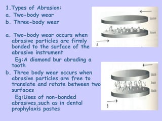 Finishing and polishing in dental materials.ppt