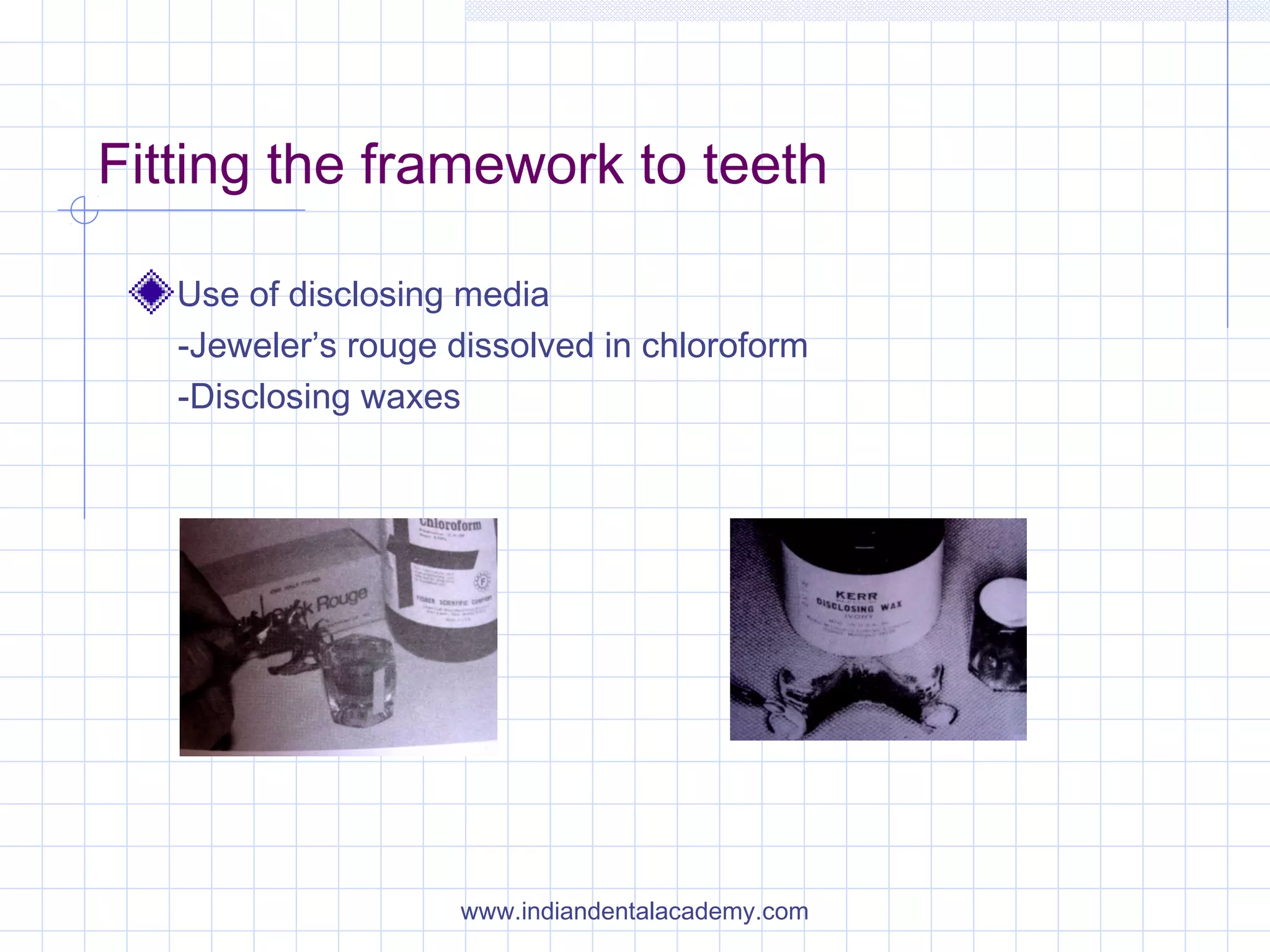 Finishing and polishing of cast metal framework/prosthodontic courses | PPT