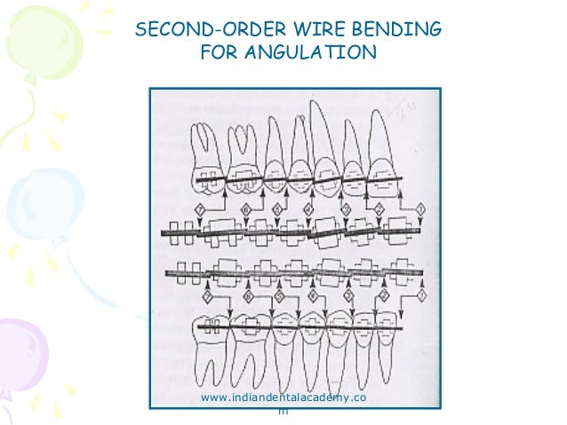 Finishing and detailing in straight wire technique / fixed orthodonti…