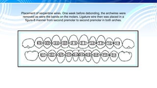 Finishing stage in Orthodontics Treatment.pptx