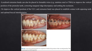 Finishing stages (dr nayaungbds phd) | PPTX