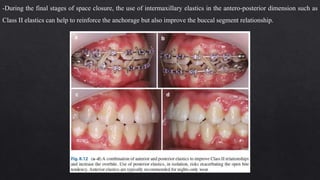 Finishing stages (dr nayaungbds phd) | PPTX