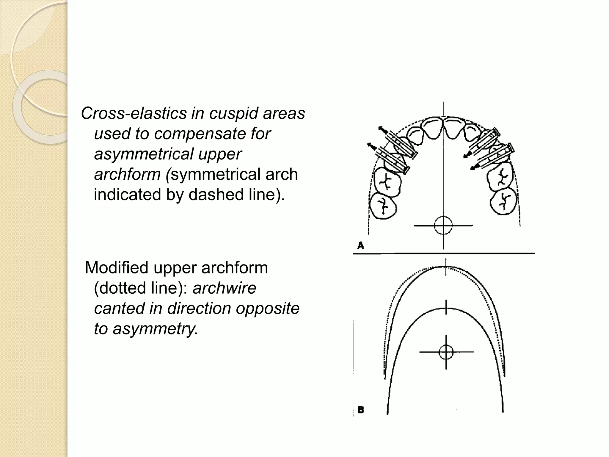 finishing and detailing in orthodontics | PPTX