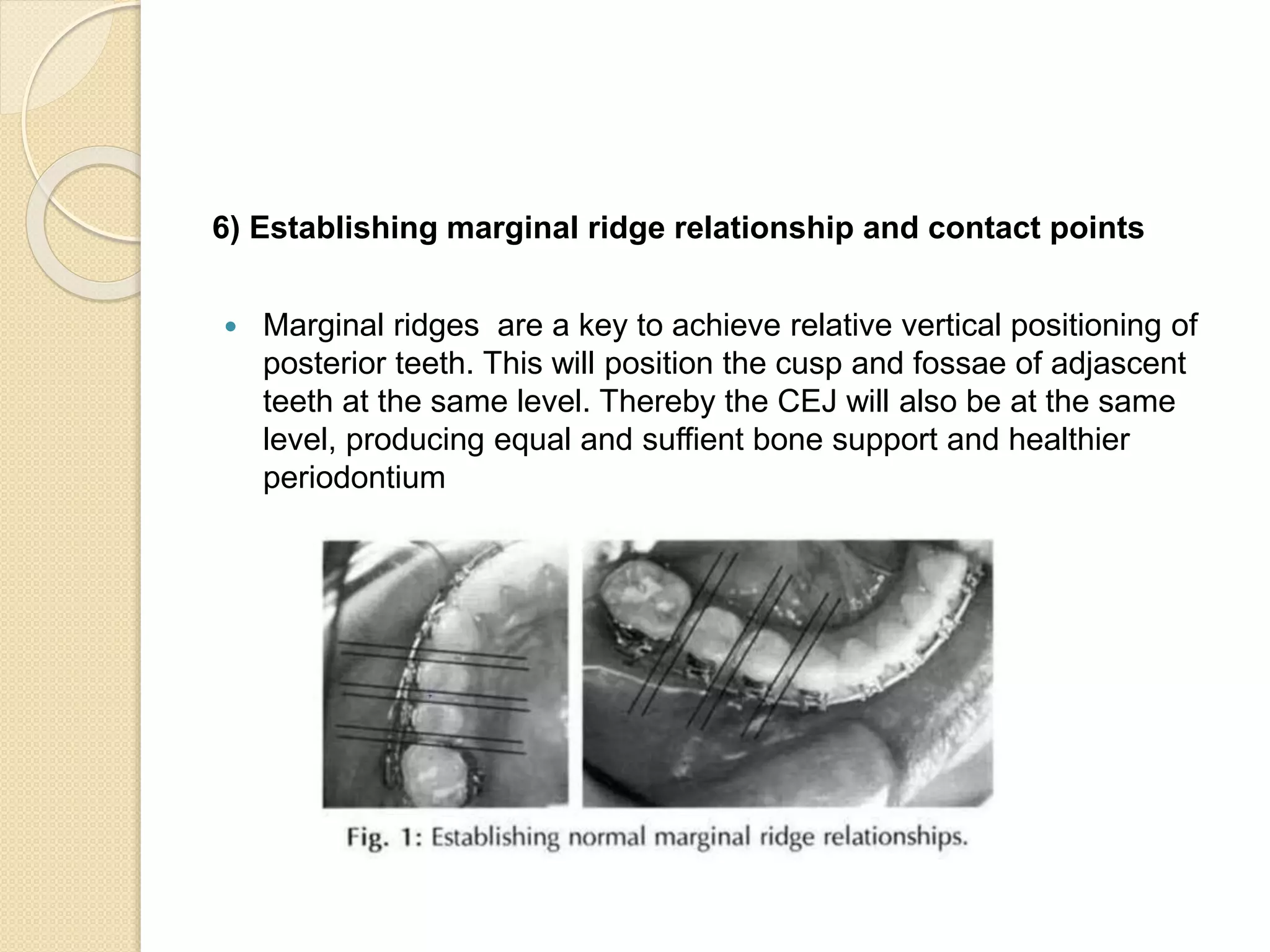 finishing and detailing in orthodontics | PPTX