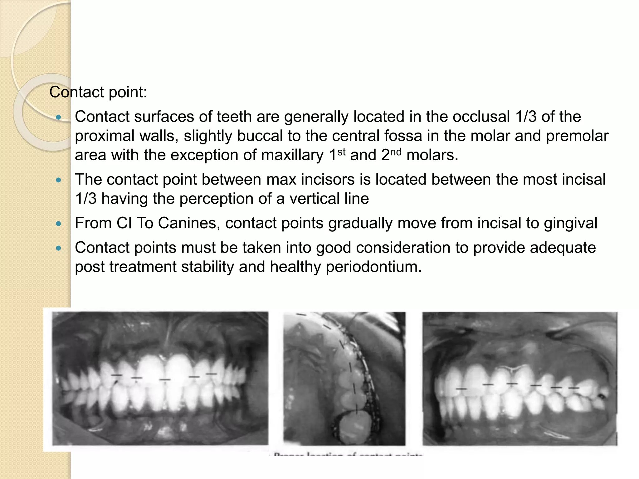finishing and detailing in orthodontics | PPTX