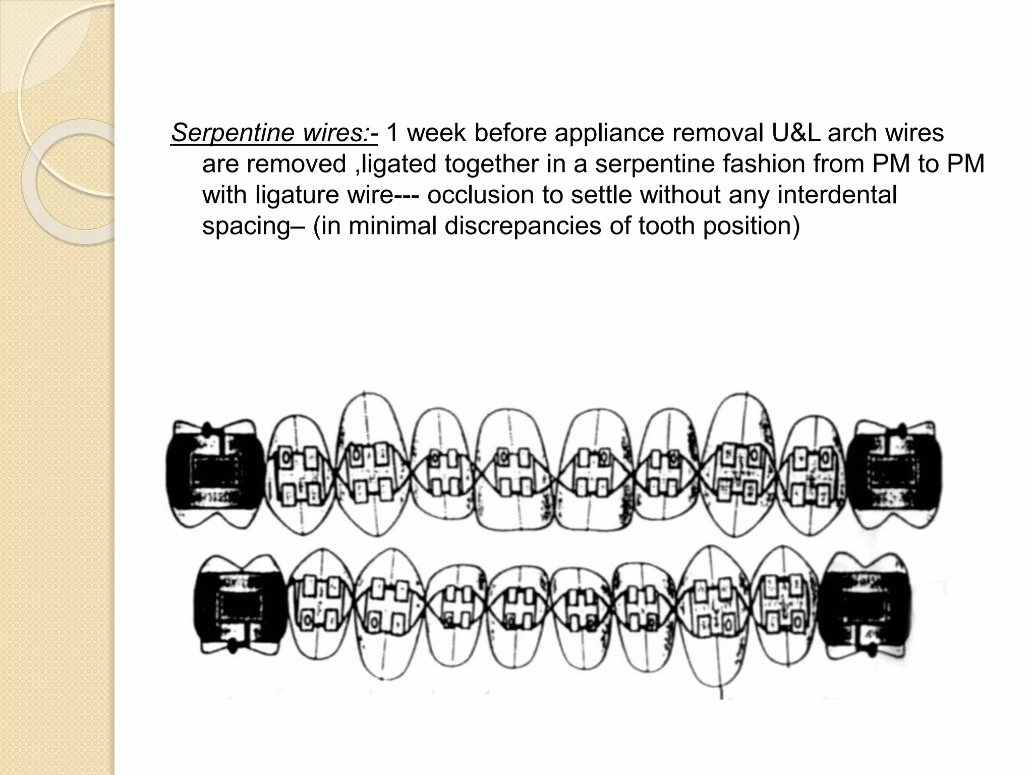 finishing and detailing in orthodontics | PPTX