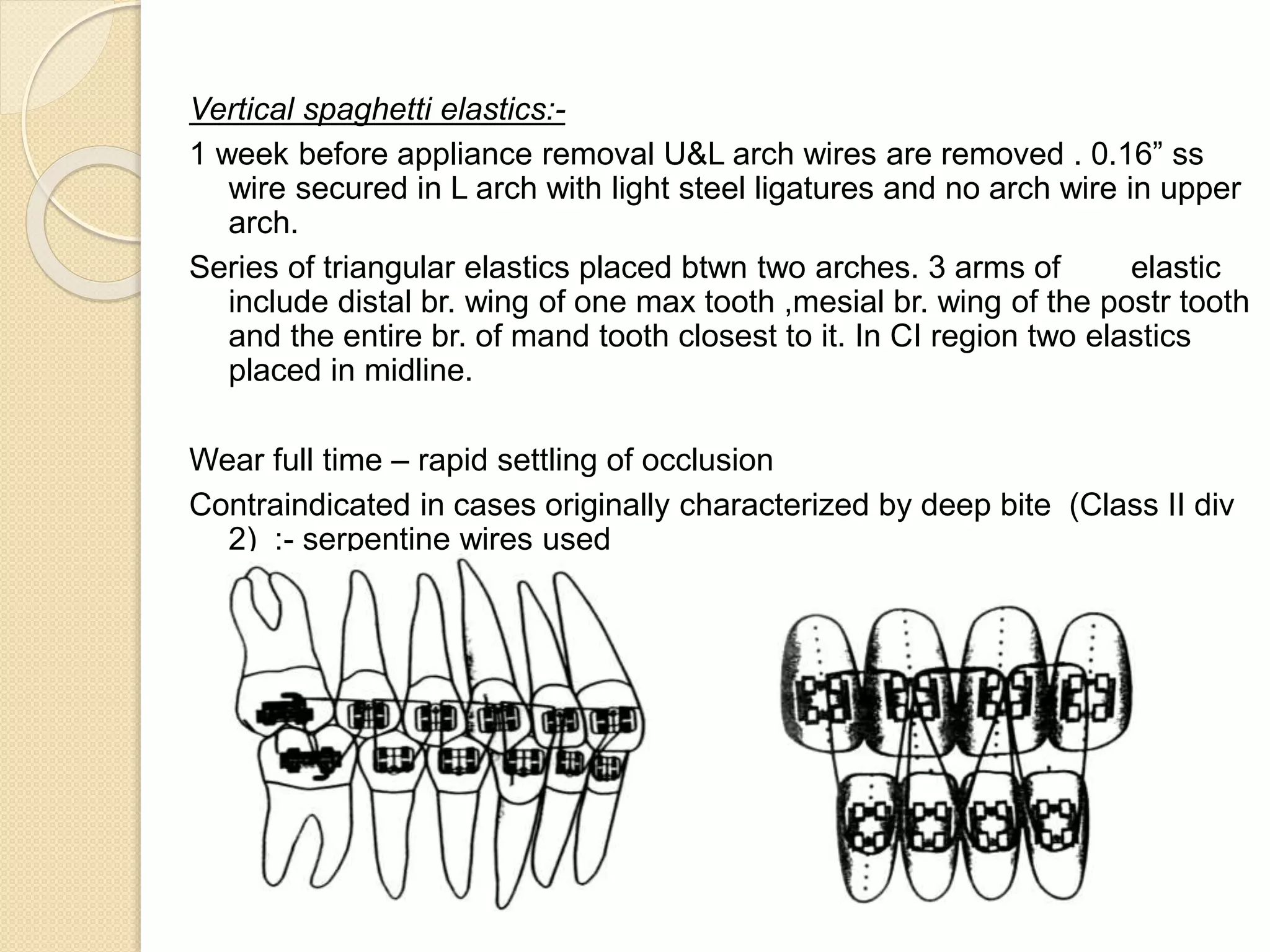 finishing and detailing in orthodontics | PPTX
