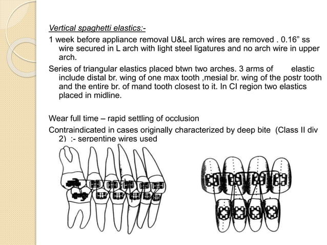 finishing and detailing in orthodontics | PPTX | Dental Health ...