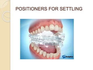 finishing and detailing in orthodontics | PPTX