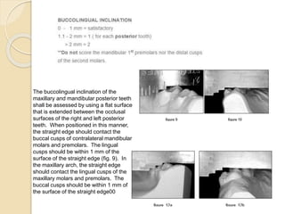 finishing and detailing in orthodontics | PPTX