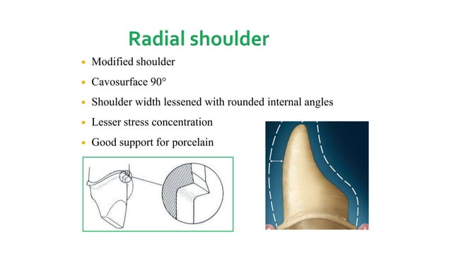 FINISH LINES.pptx | Dental Health | Diseases and Conditions
