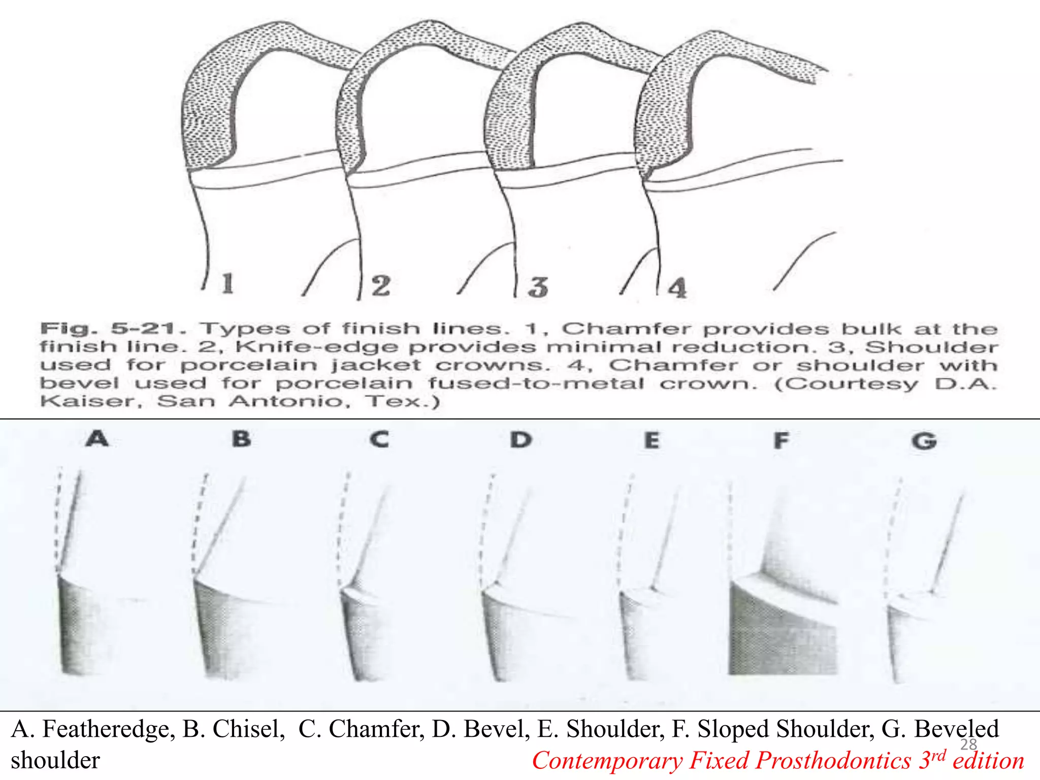 Finish lines (3) final | PPTX