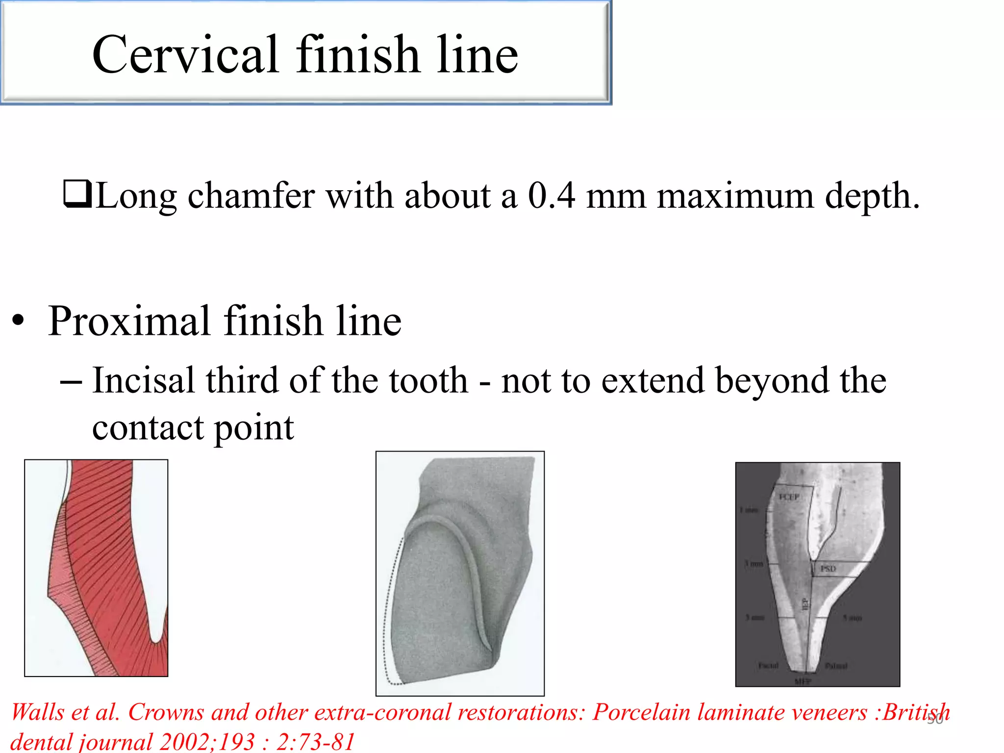 Finish lines (3) final | PPTX