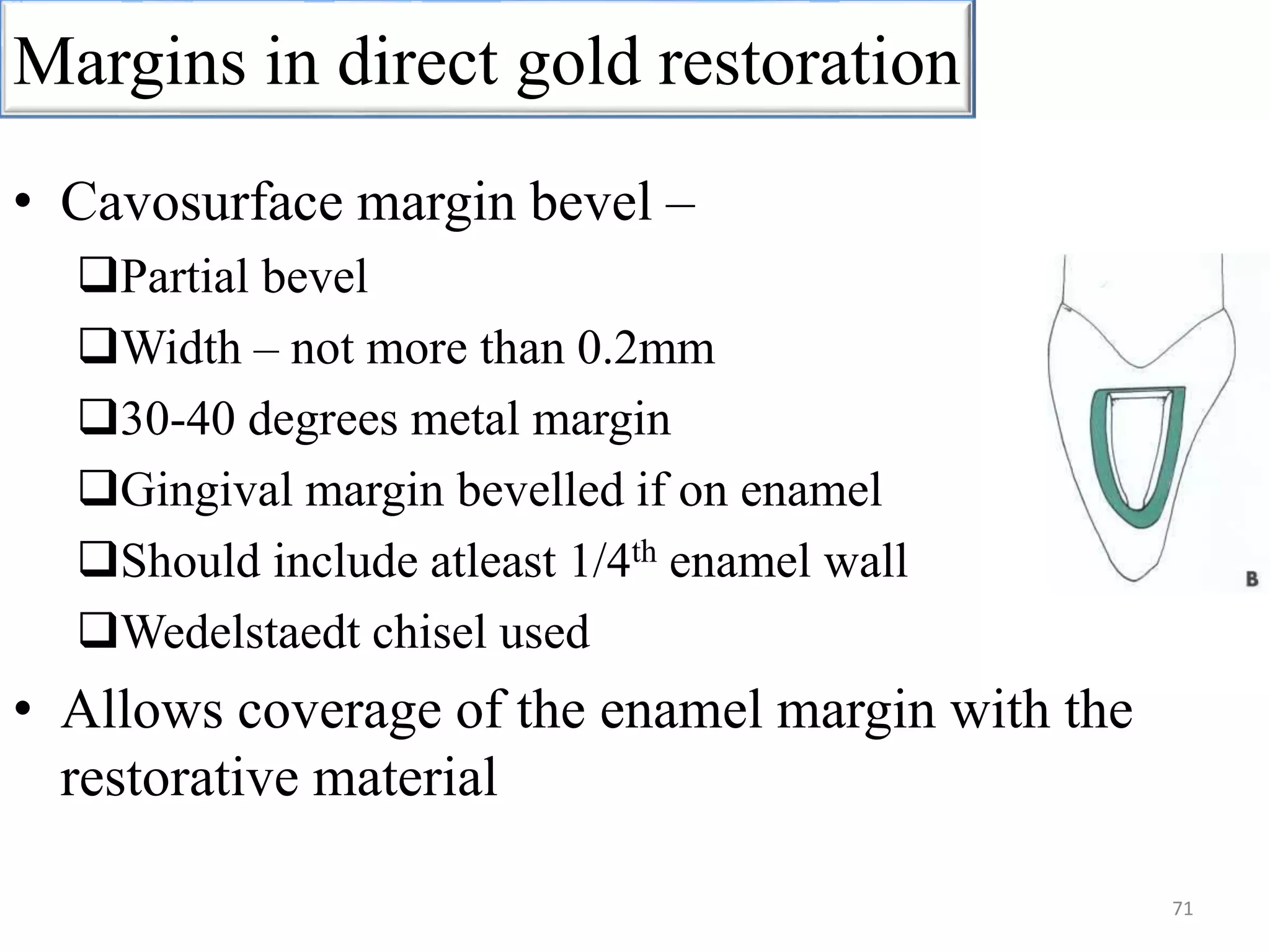 Finish lines (3) final | PPTX