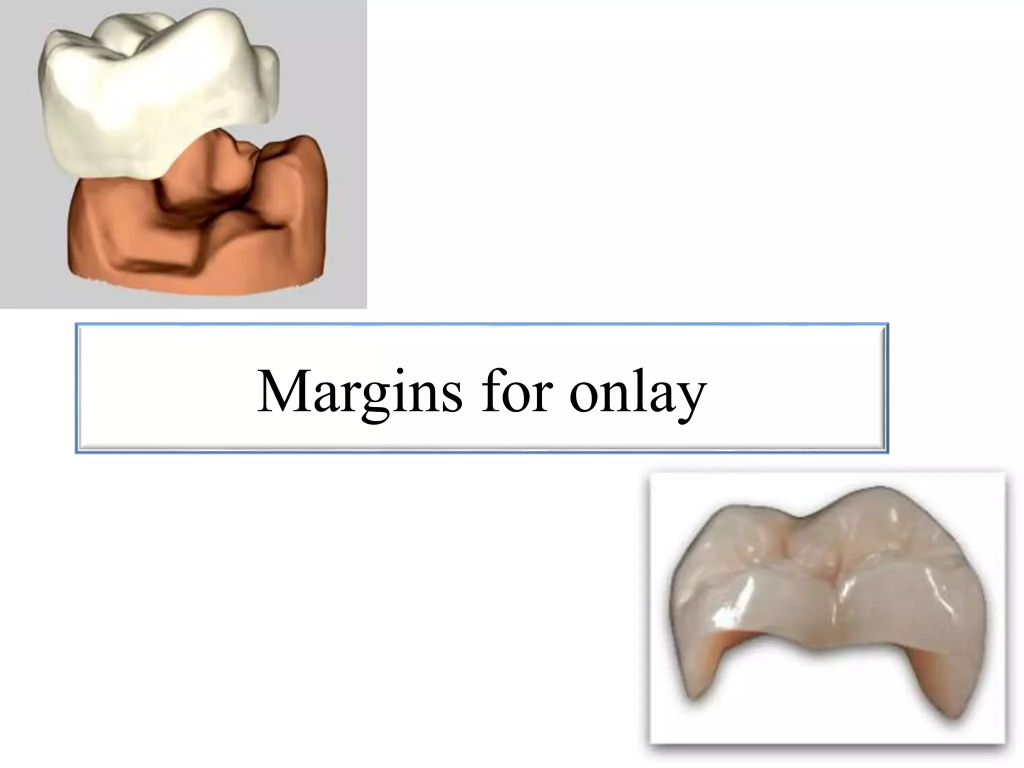 Finish lines (3) final | PPTX