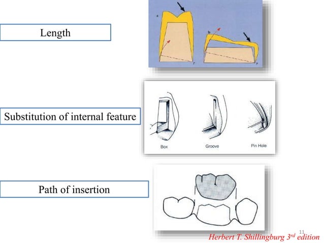 Finish lines (3) final | PPTX | Dental Health | Diseases and Conditions