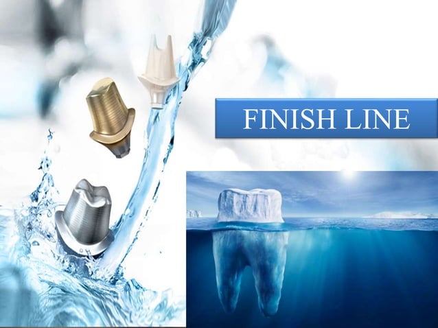 Finish lines (3) final | PPTX | Dental Health | Diseases and Conditions
