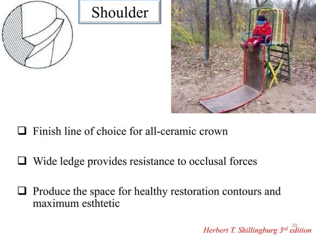 Finish lines (3) final | PPTX | Dental Health | Diseases and Conditions