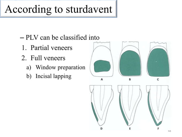 Finish lines (3) final | PPTX | Dental Health | Diseases and Conditions