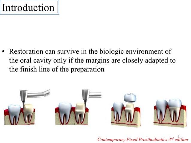 Finish lines (3) final | PPTX | Dental Health | Diseases and Conditions