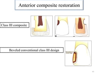 Finish lines (3) final | PPTX