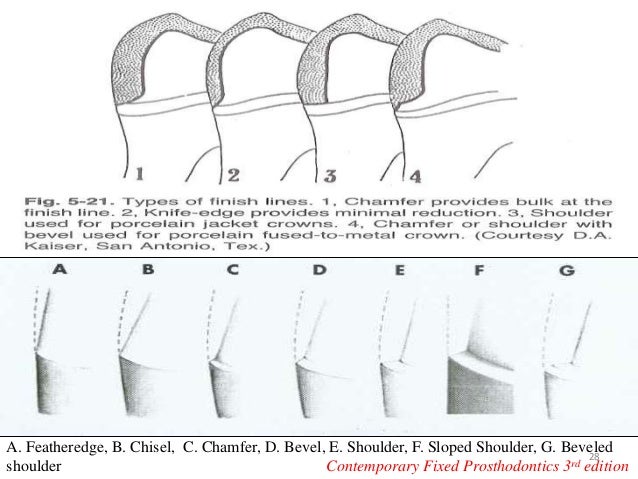 Finish lines (3) final