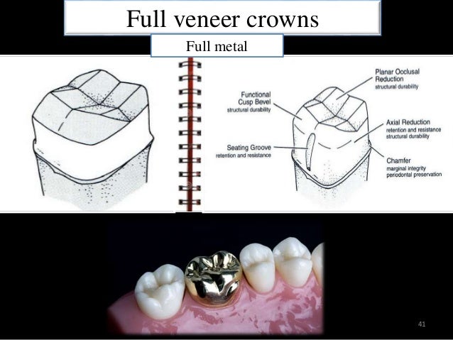 Finish lines (3) final