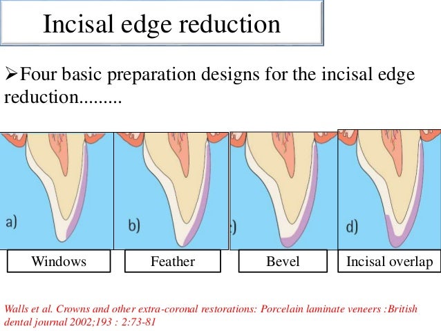 Finish lines (3) final