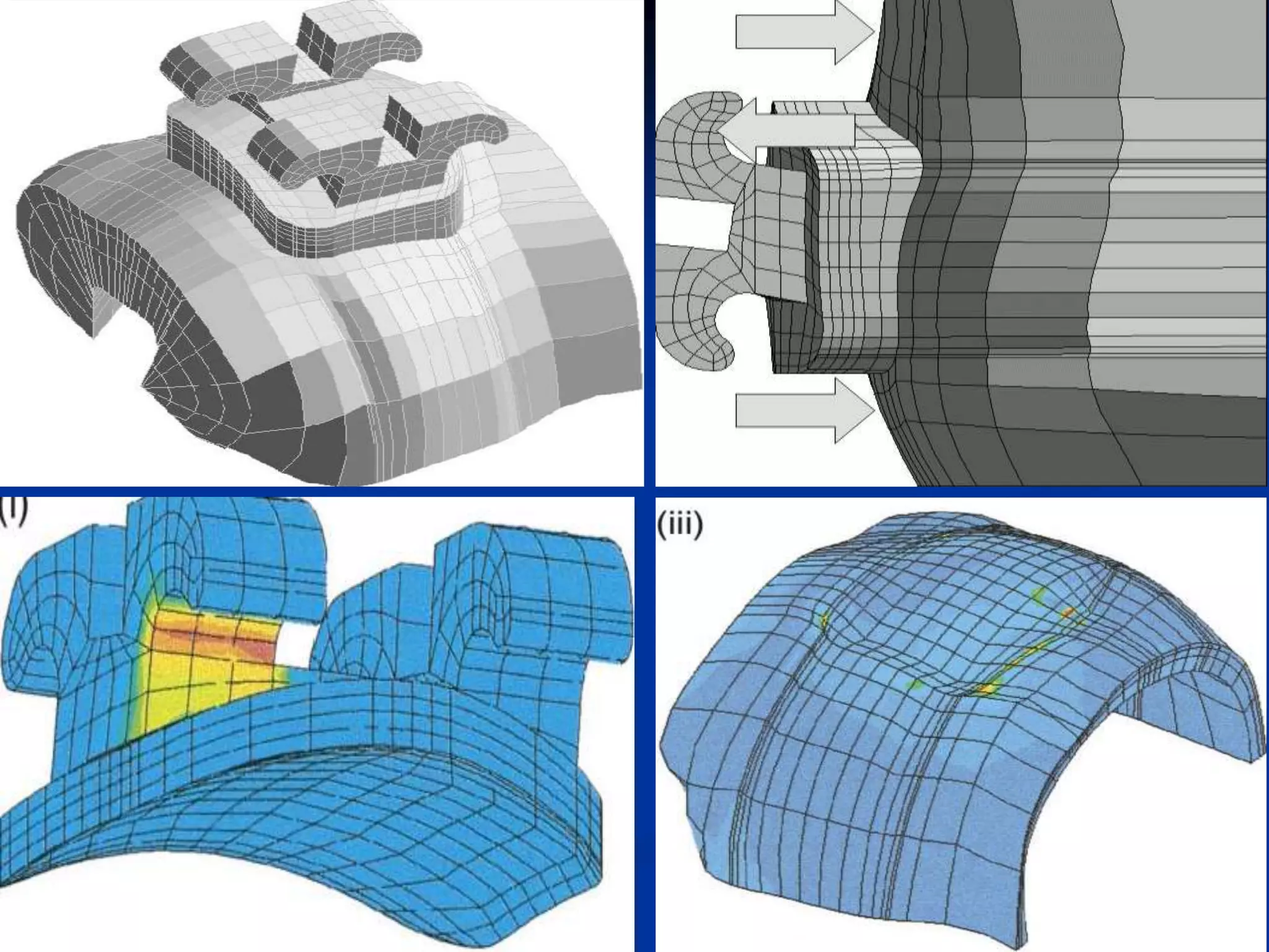 Finite element analysis in orthodontics | PPT