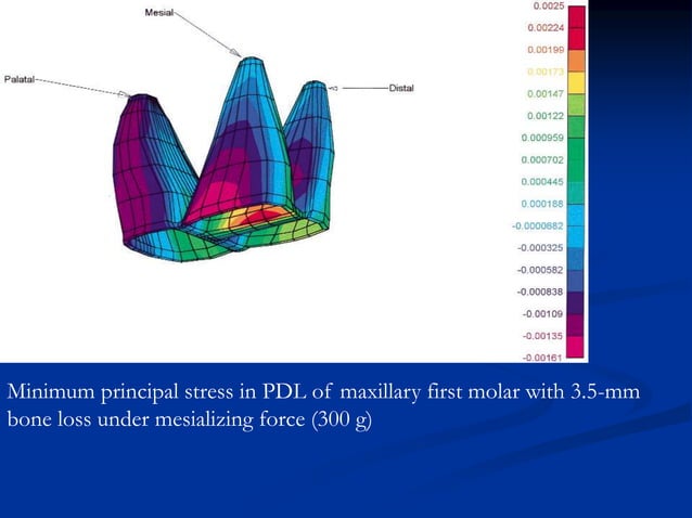 Finite element analysis in orthodontics | PPT | Dental Health ...