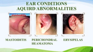 PRESENTATION ON EAR.pptx | Ear, Nose and Throat Conditions | Diseases ...