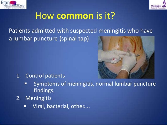 Viral Meningitis: A real pain in the neck by Dr Fiona McGill