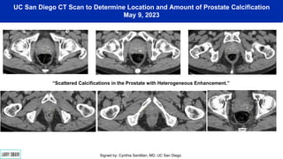 Larry Smarr’s Prostate Cancer Early Detection and Focal Therapy | PPT