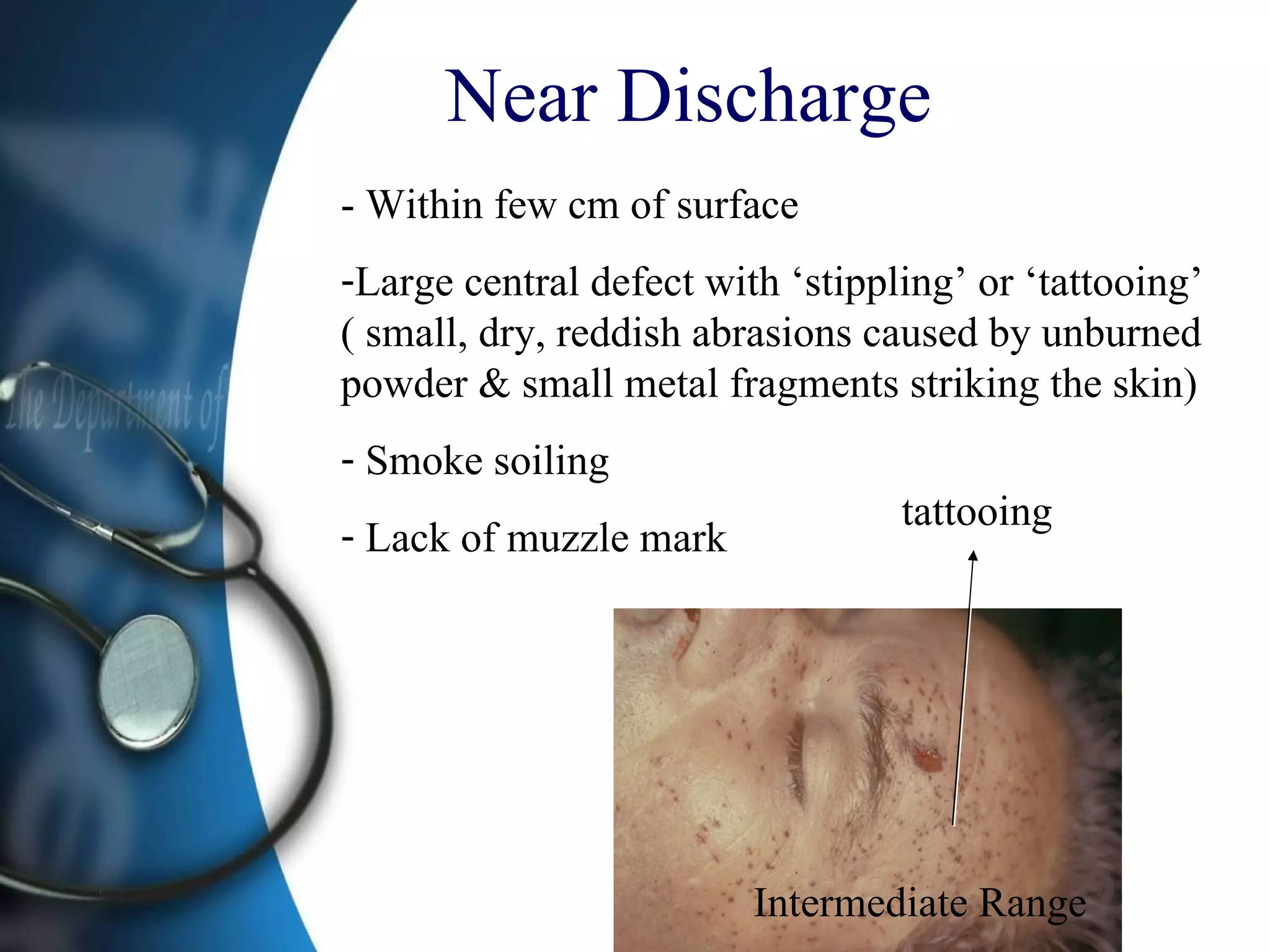 Firearm injuries | PPT