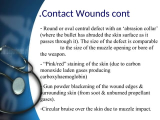 firearm-injuries Dr. Shaban 123456(1).ppt