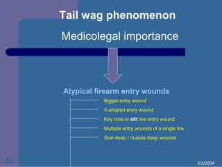 Firearm-Wounds.ppt