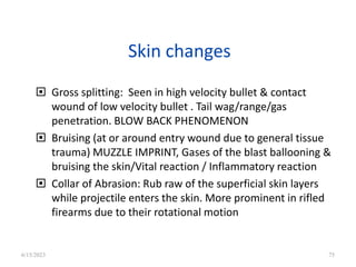 Firearm-Wounds.ppt