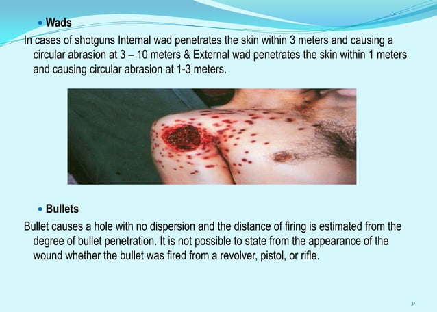 Firearm injuries
