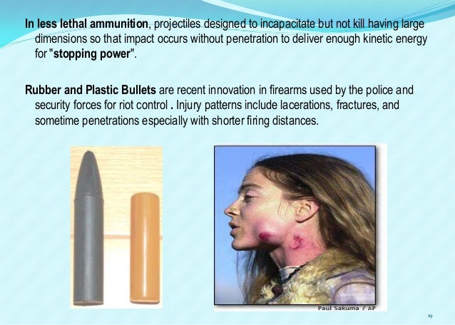 Firearm injuries