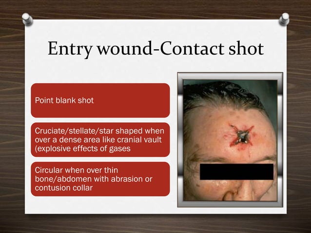 Firearm injuries_Forensics | PPTX | Arms & Ammunition | Sensitive Topics