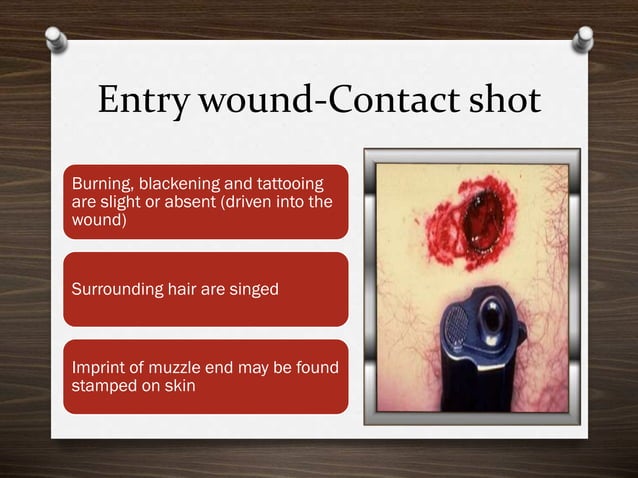 Firearm injuries_Forensics | PPTX | Arms & Ammunition | Sensitive Topics