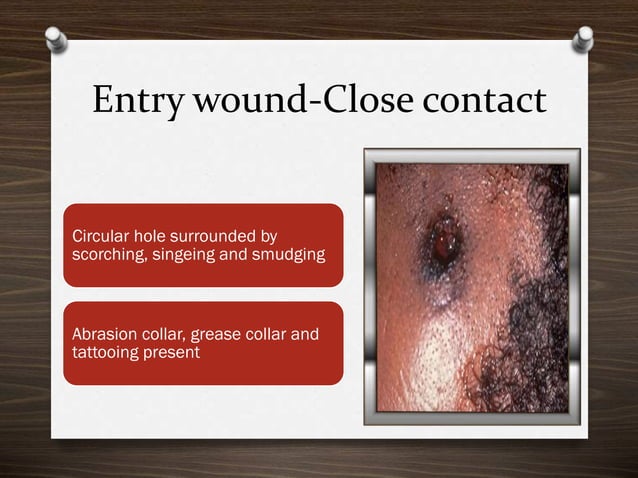 Firearm injuries_Forensics | PPTX | Arms & Ammunition | Sensitive Topics