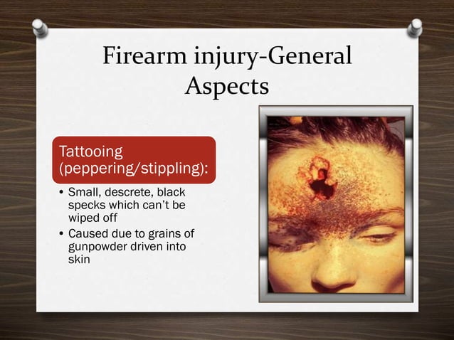 Firearm injuries_Forensics