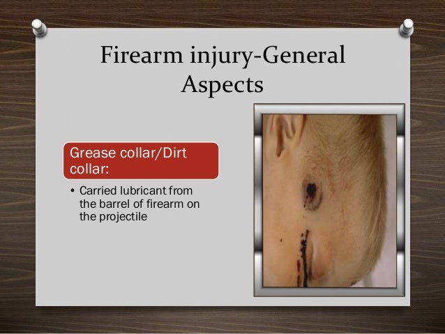 Firearm injuries_Forensics