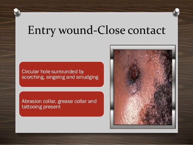 Firearm injuries_Forensics